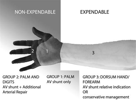 A New Classification To Aid The Selection Of Revascularization