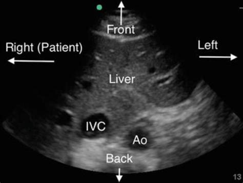 Probecraft — Mmheme
