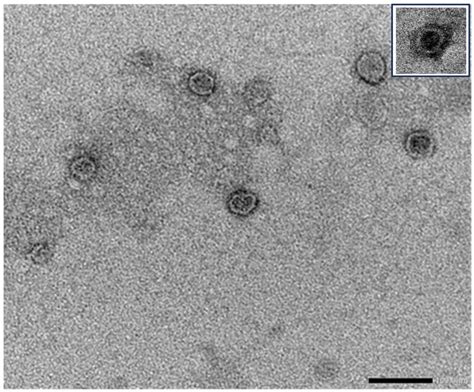 Transmission Electron Microscopy Of Plant Evs Representative Image Of