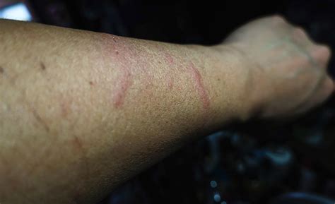 ¿amaneces Con Golpes En Tu Cuerpo Esta Es La Razón Universal México Universal México