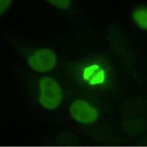 Novus Biologicalscancer Cell Development Antibody Pack 2 Vials