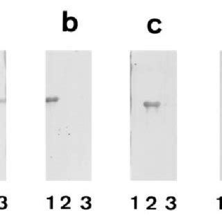 Immunoblot analysis of antibody specificity Equal quantities µg Download Scientific