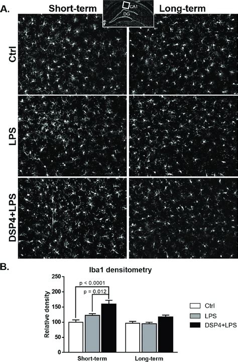 Hippocampal Iba1 Immunofluorescence Iba1 Immunofluorescent Staining In