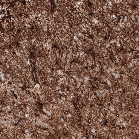 Mouse Monoclonal Anti Gfap Antibody Buy For Research Highly