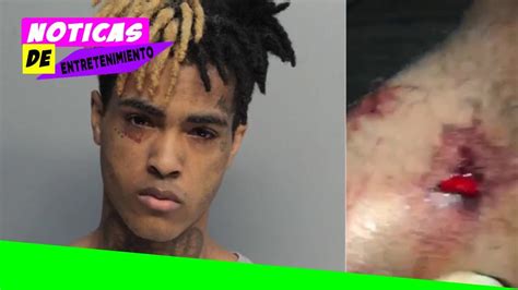 Mort De Xxxtentacion Un Quatrième Suspect Arrêté Par La Police Youtube