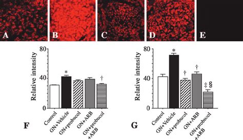 In Situ Detection Of Superoxide O 2· Ϫ In Glomeruli Of Rats That Had