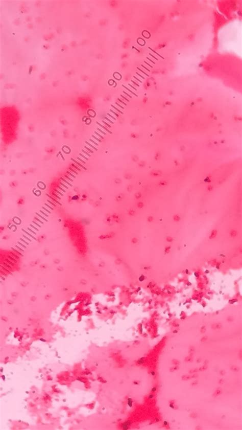 Capsule Stain Used In Microbiology Brandon Martin Kapsels