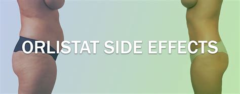 Orlistat Side Effects