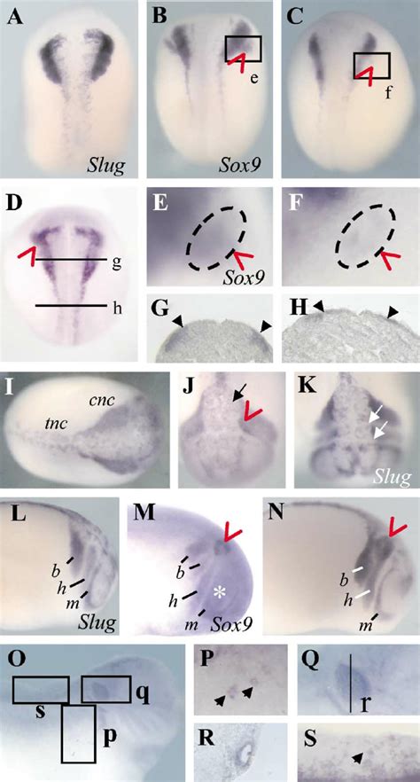 Expression Pattern Of Sox10 During Development By Whole Mount In Situ