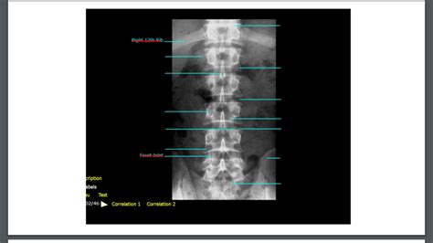 Radiograph 9 Anatomy 3 Diagram Quizlet