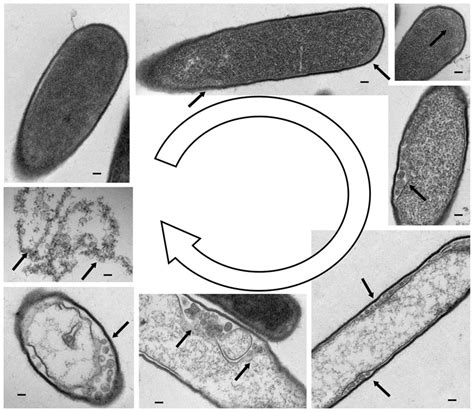 Frontiers Clostridium Difficile Phages Still Difficult