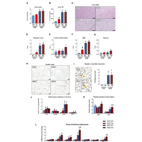 Tn Conditions Potentiate The Development Of Hepatic Steatosis And