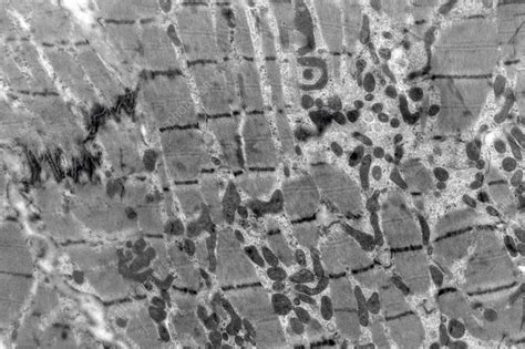 Cardiomyopathy Tem Stock Image C0569804 Science Photo Library