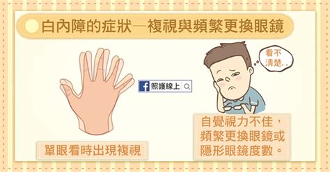 視力模糊又怕光，醫師分析白內障有這 5 個常見症狀 照護線上 健康遠見 對身體好！