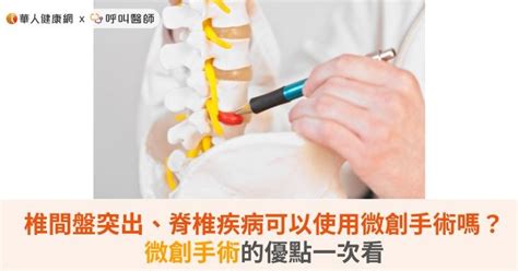 椎間盤突出、脊椎疾病可以使用微創手術嗎？微創手術的優點一次看 華人健康網 專業即時優質的健康新聞及資訊分享平台業即時優質的健康新聞及