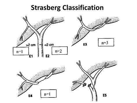 Cpc Bile Duct Injuries Pptx Digestive Disorders Diseases And Conditions