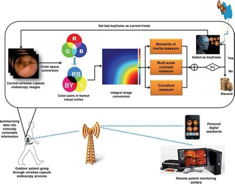 Overall View Of The Proposed Video Summarization Based Tele Endoscopy Download Scientific