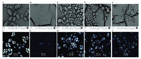 Microscopic Observation Of Starch Granules In Mature Potato Tubers