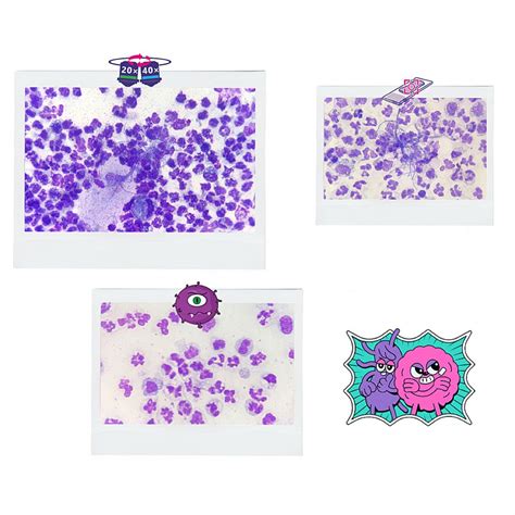 Ioana Sandu On Linkedin Pyothorax From A Cat Filamentous Bacteria Can