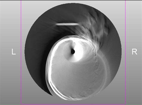 Hole In Fdk Reconstruction With Data Overlap · Issue 392