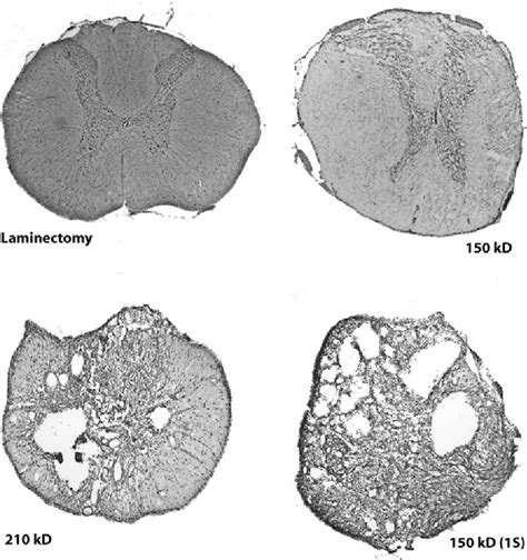 Figure 1 From Persistent Polyuria In A Rat Spinal Contusion Model