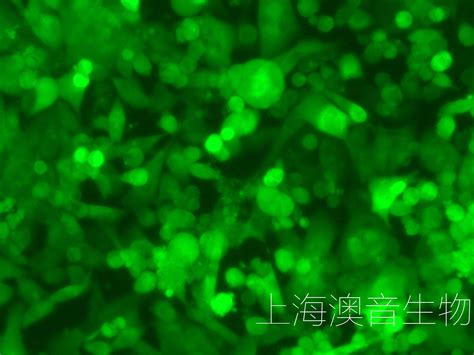 Bt 549 Luc Gfp Puro双标记的人乳腺管癌细胞 企业官网