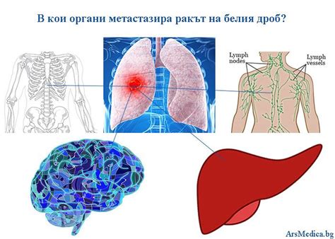 Повишено СУЕ скорост на утаяване на еритроцитите Arsmedica Bg