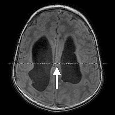 Mr Imaging Artifacts And Parallel Imaging Techniques With Calibration Scanning A New Twist On