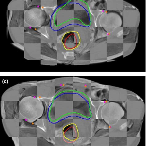 The Structure Of The Fully Convolutional Network Fcn Moving Image