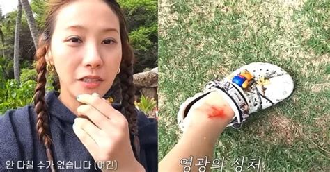 하와이 수영 중 피 흘린 여배우여긴 안 다칠 수 없어 왜