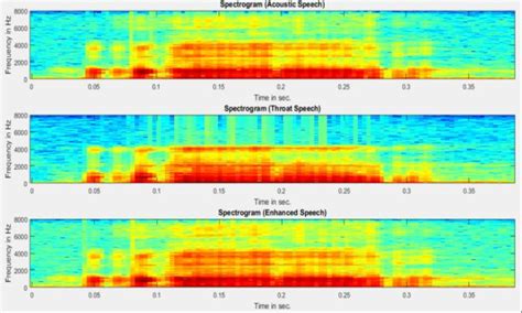 Speech Spectrogram Comparison Between The Acoustic Speech Throat Download Scientific Diagram