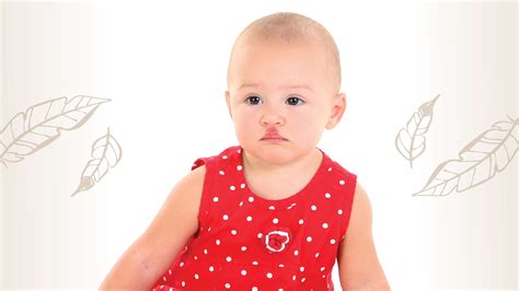 Nevus Simplex Newborn