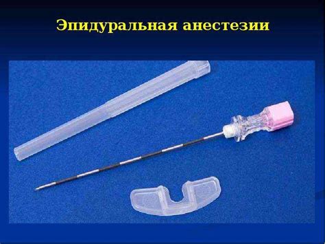 Эпидуральная анестезия - медицинский портал eurolab