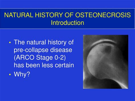 Ppt Natural History Of Osteonecrosis Of The Femoral Head Prediction Based On Mri Powerpoint