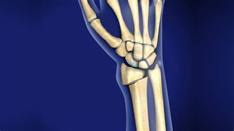 Ulna Wrist Fracture