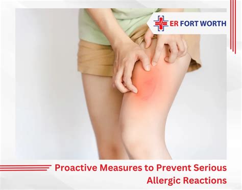 Severe Allergic Reaction Why Fort Worth Er Is Best Option