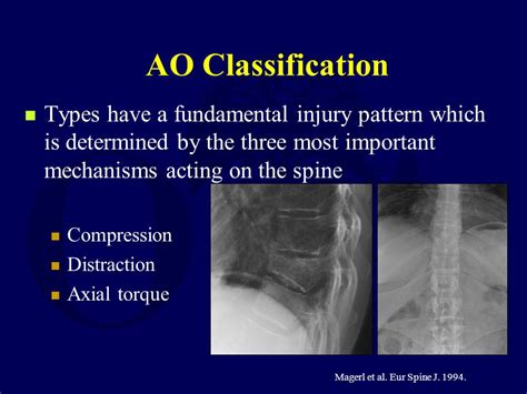 Classification Of Thoracolumbar Spine Injuries Ppt Video Online Download