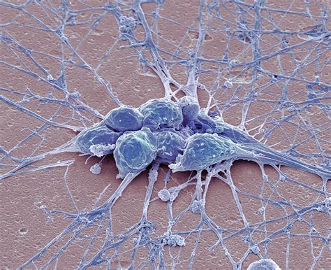Neurones Sem Stock Image C0566019 Science Photo Library