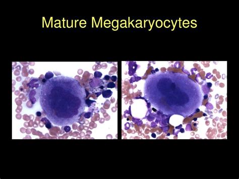 Ppt Bone Marrow Evaluation Powerpoint Presentation Id 671342