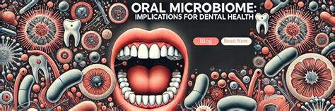 The Role Of Oral Microbiome In Dental Health