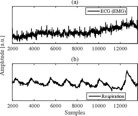 Figure 1 From Using Cardio Respiratory Signals To Recognize Emotions Elicited By Watching Music