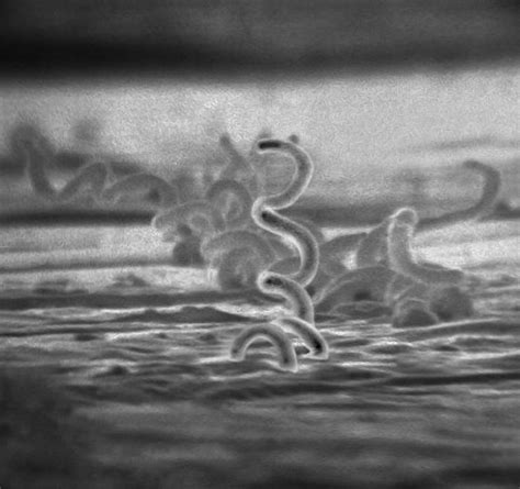 Syphilis Public Health Manitoba Health Seniors And Active Living