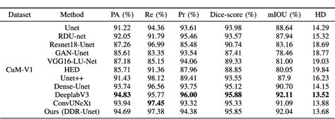 Table VIII From DDR Unet A High Accuracy And Efficient Ore Image