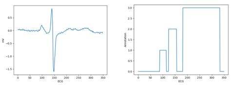 GitHub Elahesalari Recurrent Neural Networks RNN Detection And Identification Of