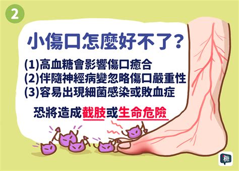 講糖 併發症 足部 足部有傷口，怎麼照護才安全？