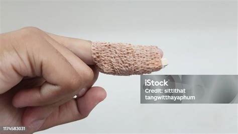 손가락 직기 또는 안정제 망치 손가락 및 건염의 치료를 위해 손가락을 고정하고 지원하는 데 사용되는 의료 기기입니다 의료 장비