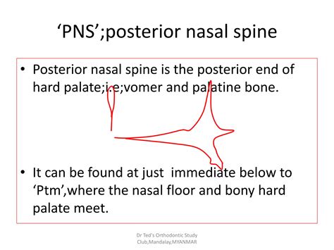 Practical Cephalometric Tracing Pptx