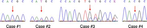 The Result Of Direct Sequencing To Detect Exon 20 Tyrosine Kinase Download Scientific Diagram