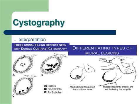Ppt Most Common Contrast Studies In Radiology Basic Principles For