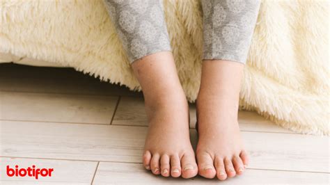 Cara Mengatasi Kaki Bengkak Saat Hamil Biotifor